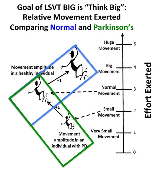Believe In Big Movements Of LSVT BIG Physical Therapy For Parkinson’s ...