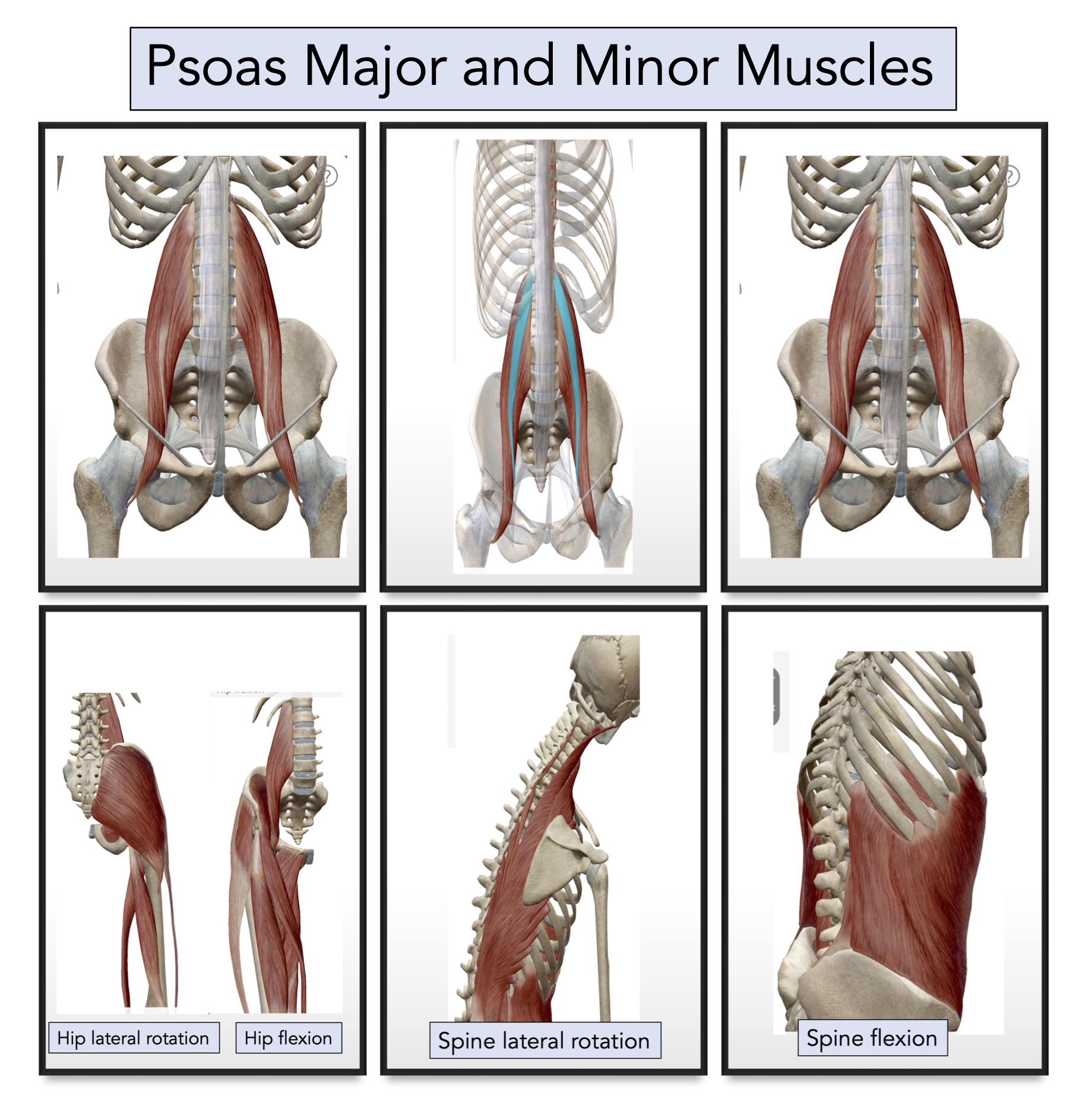 Journey with Parkinson’s: Rigid and Sore Muscles (Psoas, Piriformis ...