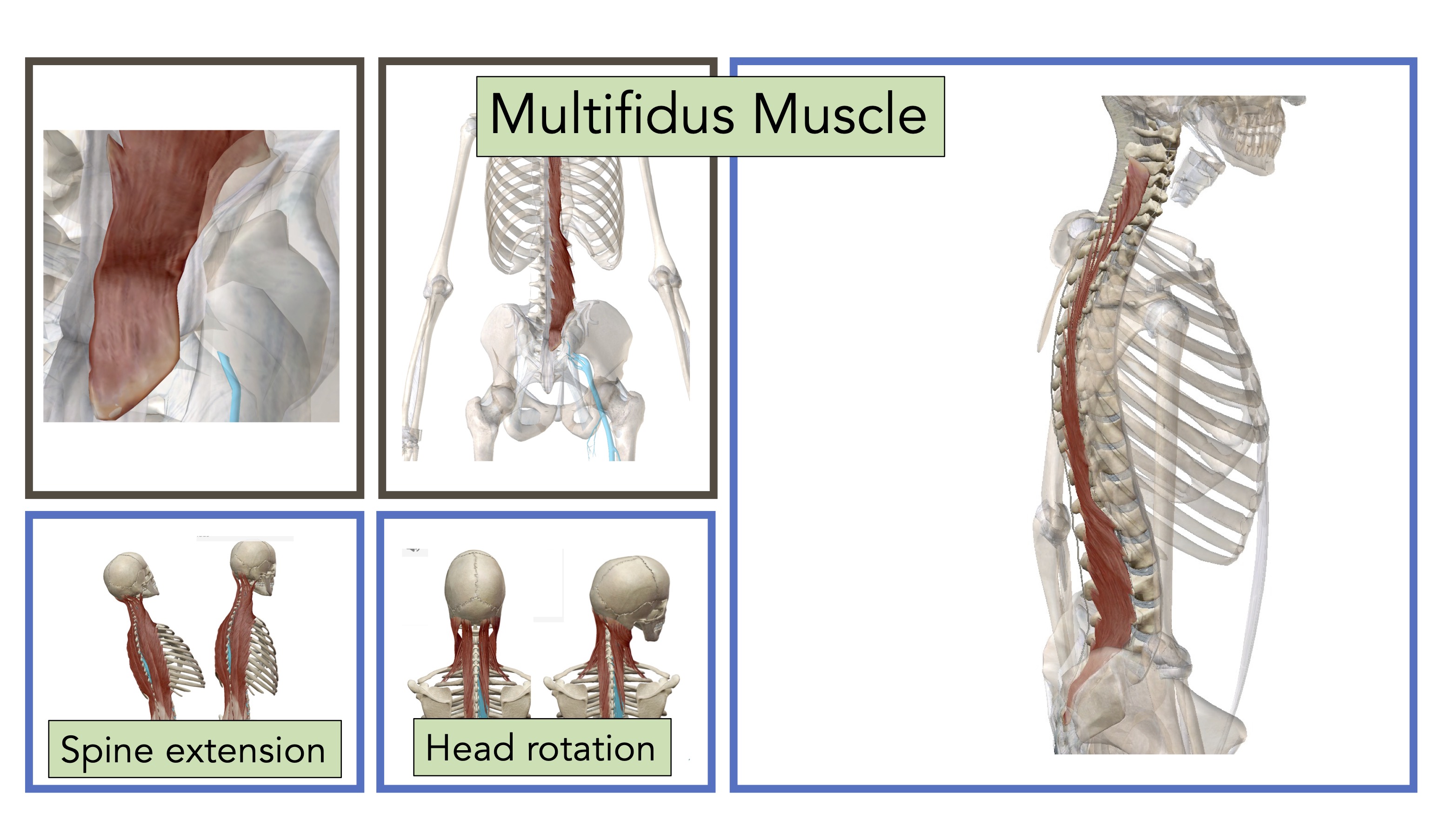 Journey with Parkinson’s: Rigid and Sore Muscles (Psoas, Piriformis ...